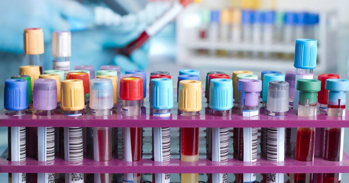Bioanalytical Research Support | NSF